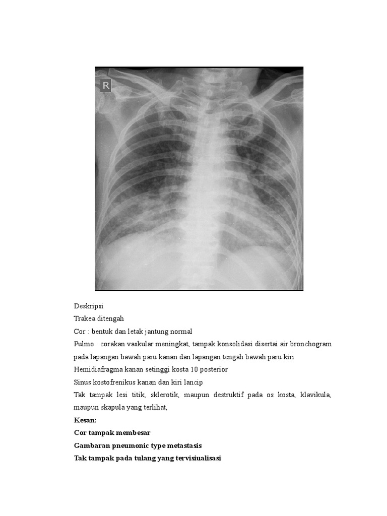 Foto Thorax Dan Deskripsi | PDF | Seni