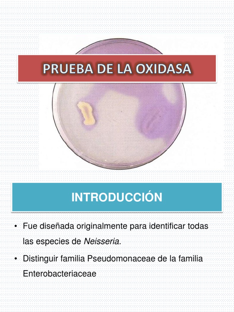 Prueba de La Oxidasa | Microbiología | Procariota