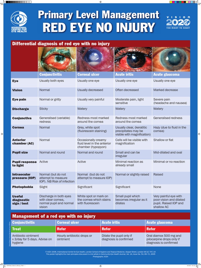 Red Eye Poster Hires | PDF | Ophthalmology | Medical Specialties