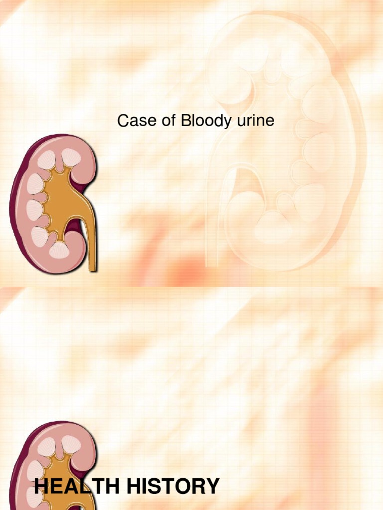 Case of Bloody Urine | PDF | Urinary Tract Infection | Urology