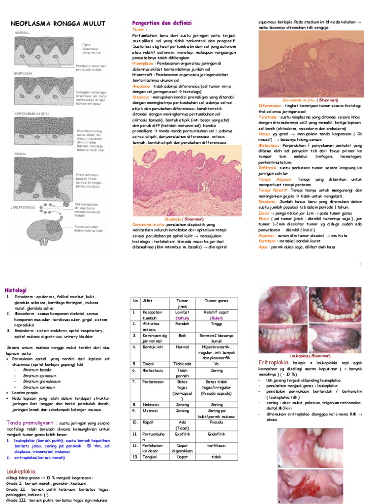Oral Neoplasma | PDF