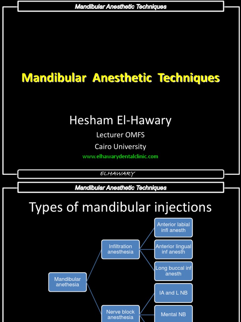 Mandibular Anesthetic Techniques | Anesthesia | Injection (Medicine)