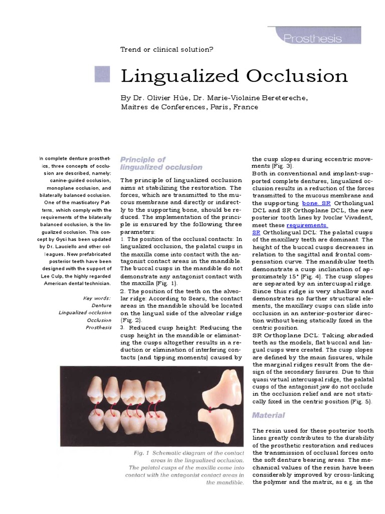 Lingualized Occlusion Dental Lab International.pdf | Dentures | Tooth