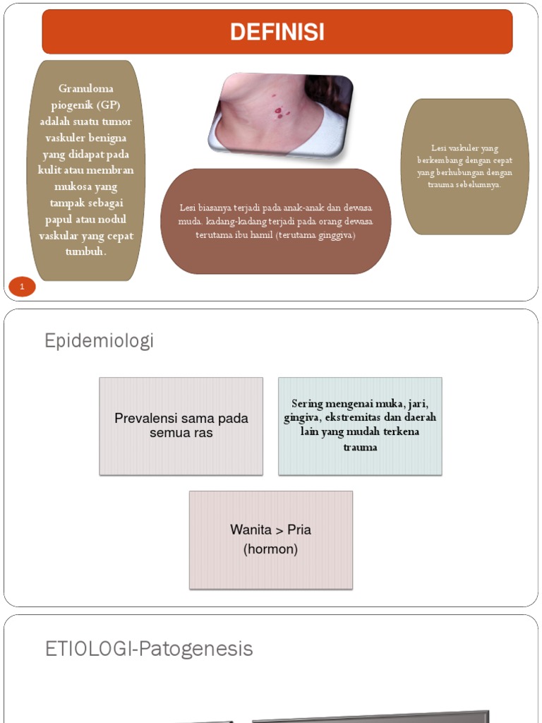 Granuloma Pyogenik | PDF