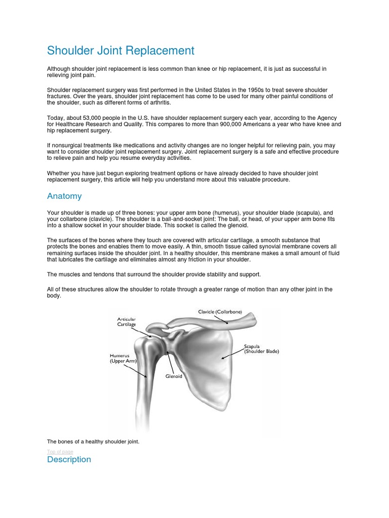 Shoulder Joint Replacement | PDF | Shoulder | Osteoarthritis