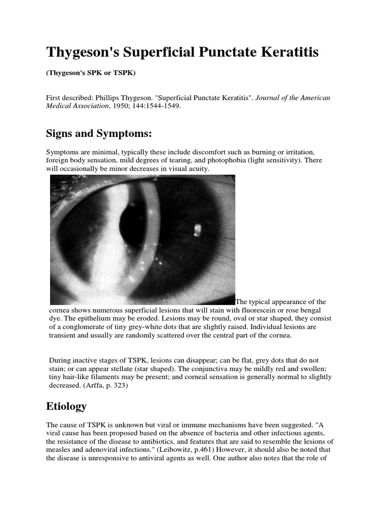 Thygeson's Superficial Punctate Keratitis: Signs and Symptoms | PDF ...