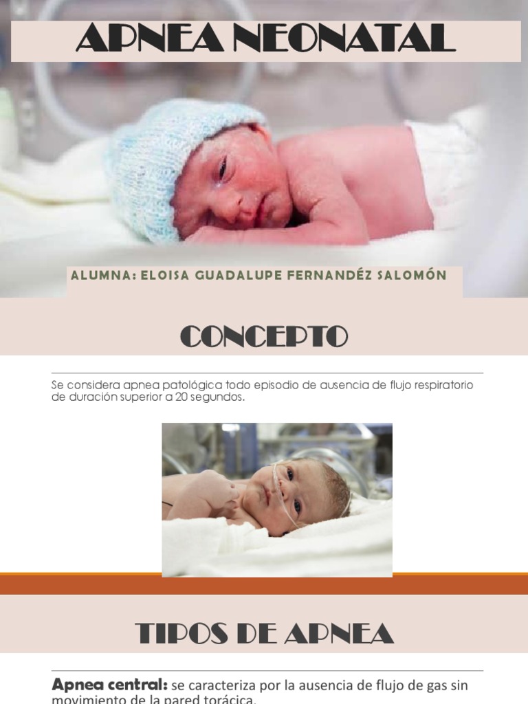 Apnea Neonatal | PDF