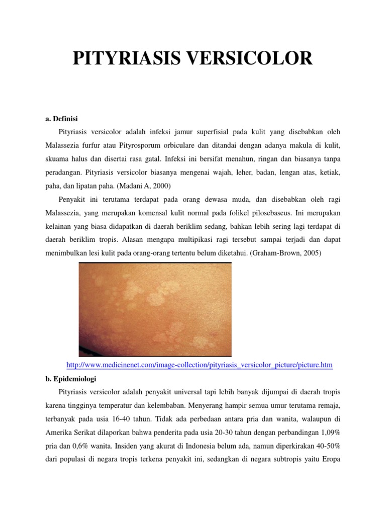 Pityriasis Versicolor Pdf , PATIENT INFORMATION LEAFLET PITYRIASIS ...