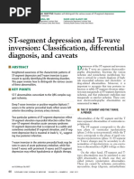 Ecg Interpretation J Point Stemi Criteria Equivalents and Others | PDF ...