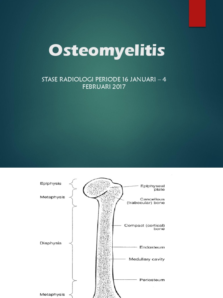 Osteomyelitis | PDF