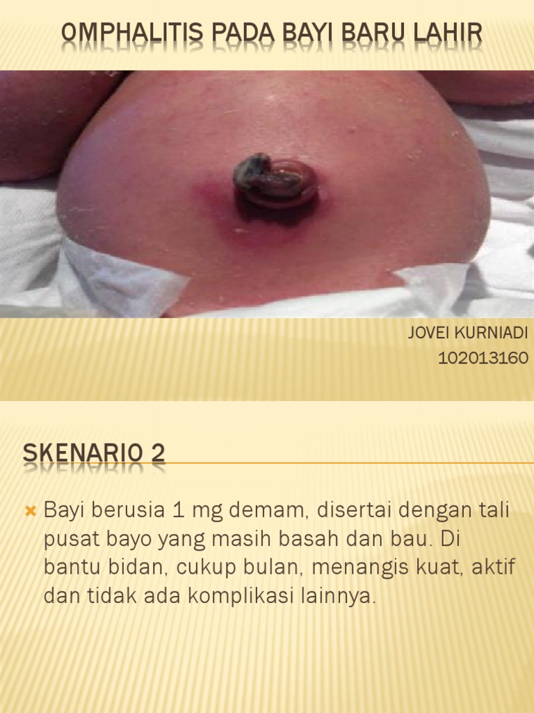 s.12 Omphalitis Pada Bayi Baru Lahir | PDF