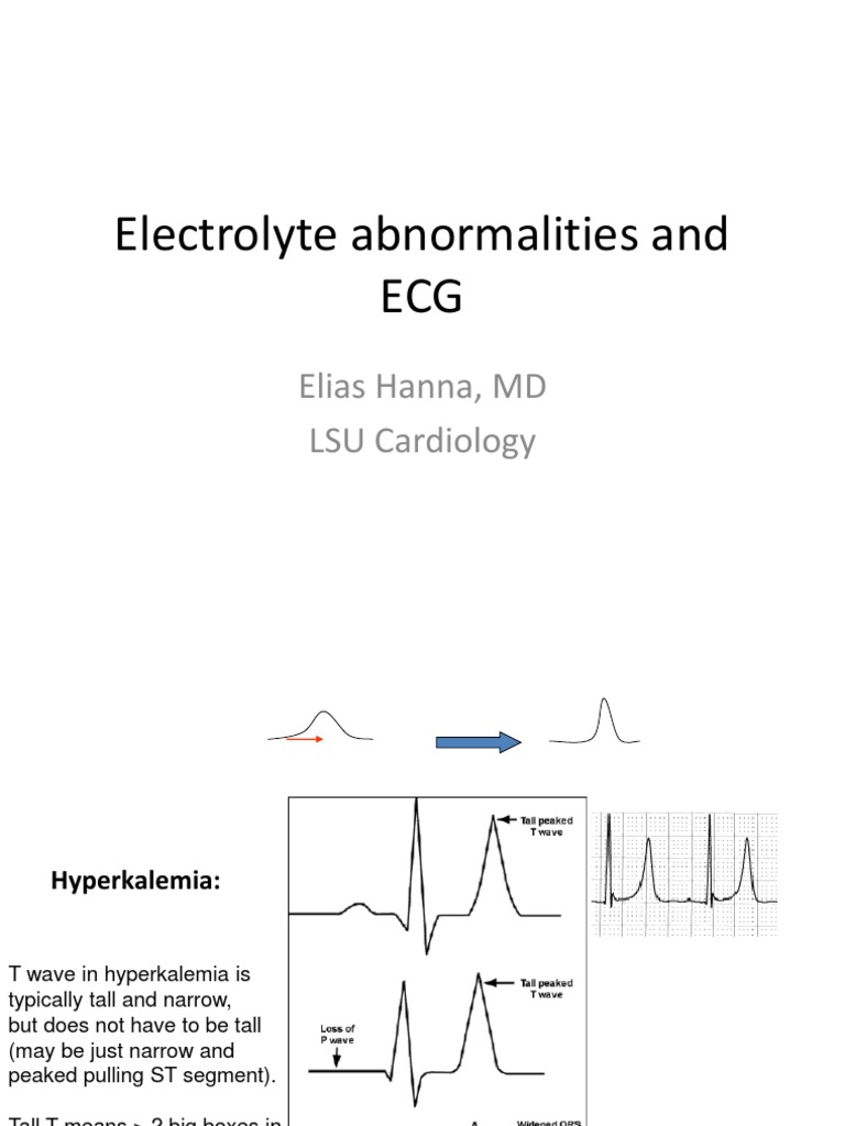 Electrolyte Abnormalities and ECG: Elias Hanna, MD LSU Cardiology | PDF ...