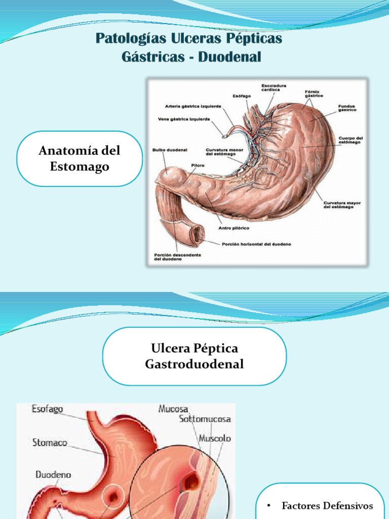 Anatomía del Estomago | Úlcera péptica | Medicina CLINICA