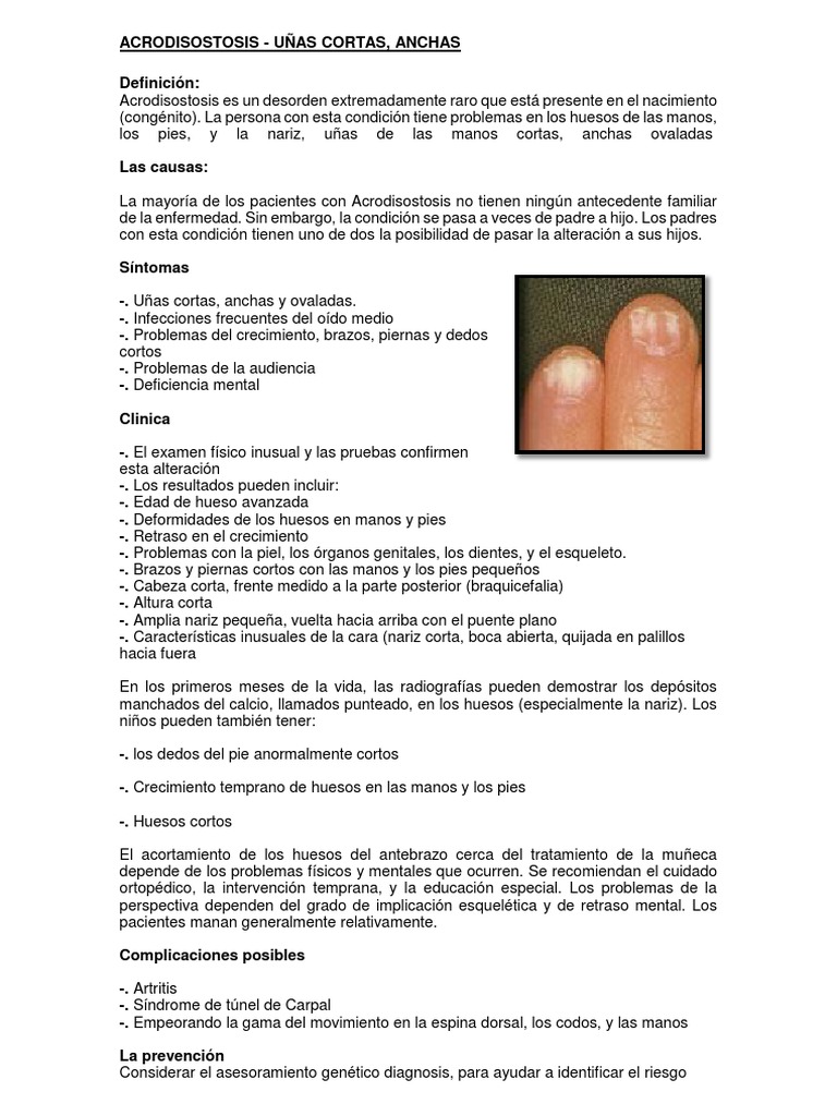 Acrodisostosis y Alteraciones Ungueales | PDF | Clavo (anatomía) | Alergia
