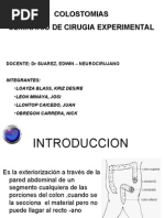 Cirugía de Hartmann: Técnica y Procedimiento | PDF | Cáncer colonrectal ...