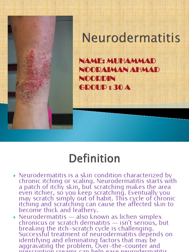 Neuro Dermatitis | PDF | Dermatitis | Allergy