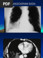 Scottie Dog Sign (Spine) Radiology Reference Article | PDF | Vertebral ...
