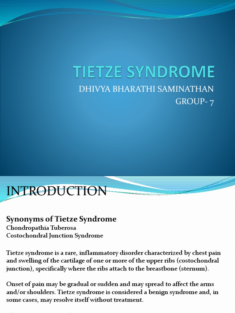 Tietze Syndrome | Thorax | Musculoskeletal System