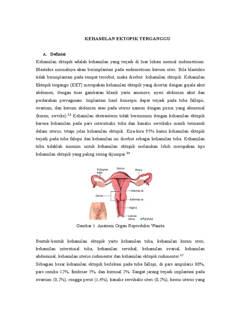 Kehamilan Ektopik Terganggu