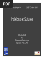 Types et techniques de points de suture | PDF | Suture (médecine ...