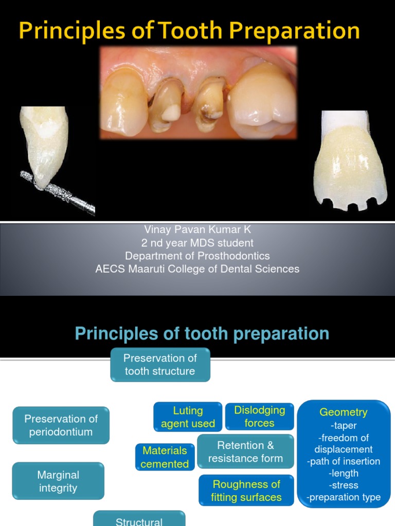 Biomechanical Tooth Preparation Principles for BDS final year students ...