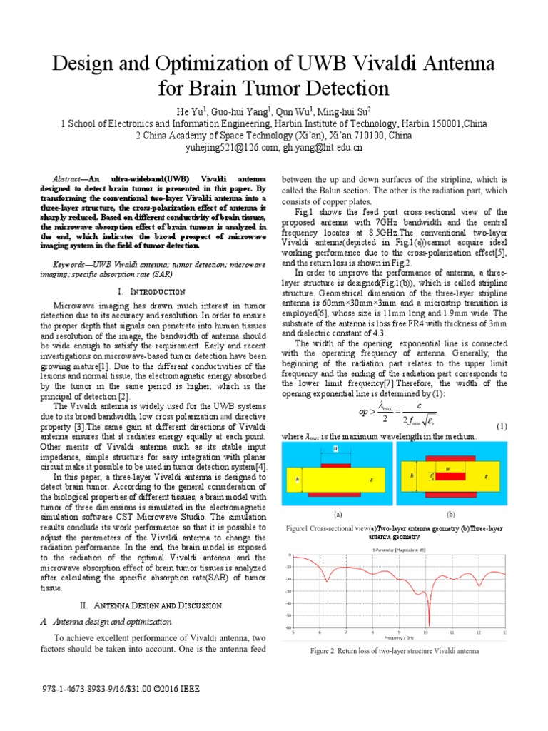 Design and Optimization of UWB Vivaldi Antenna For Brain Tumor ...