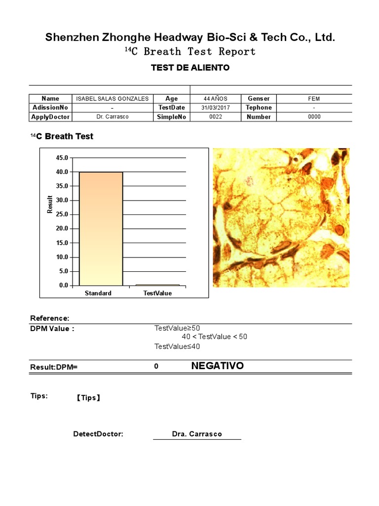 Shenzhen Zhonghe Headway Bio-Sci & Tech Co., LTD.: C Breath Test Report ...