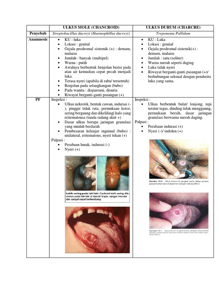 Tugas Ulkus Mole Dan Ulkus Durum | PDF