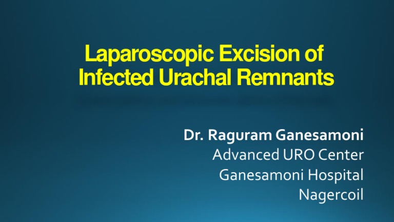 Laparoscopic Excision of Infected Urachal Remnants | PDF