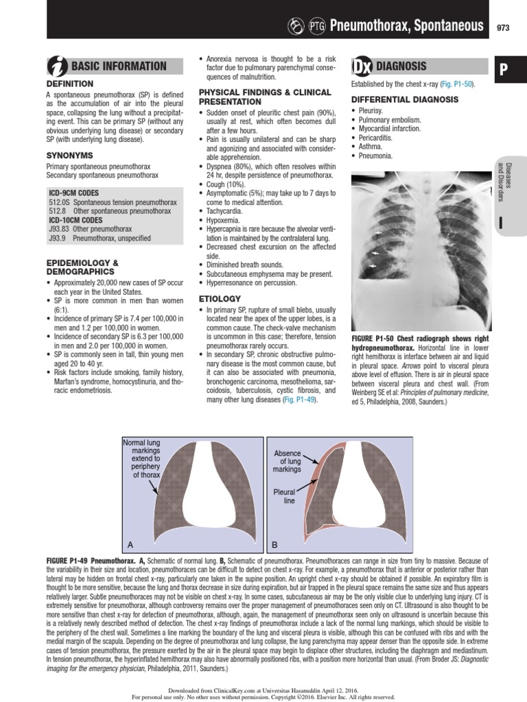 Pneumothorax, Spontaneous: Basic Information Diagnosis | PDF | Lung ...