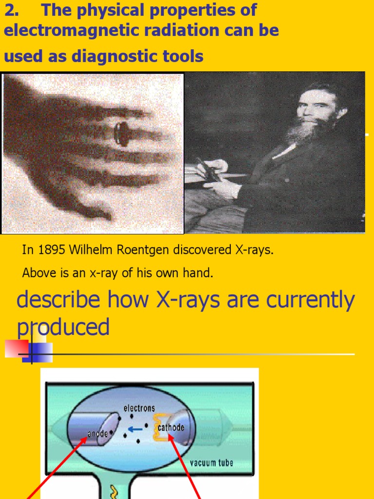 In 1895 Wilhelm Roentgen Discovered X-Rays. Above Is An X-Ray of His ...