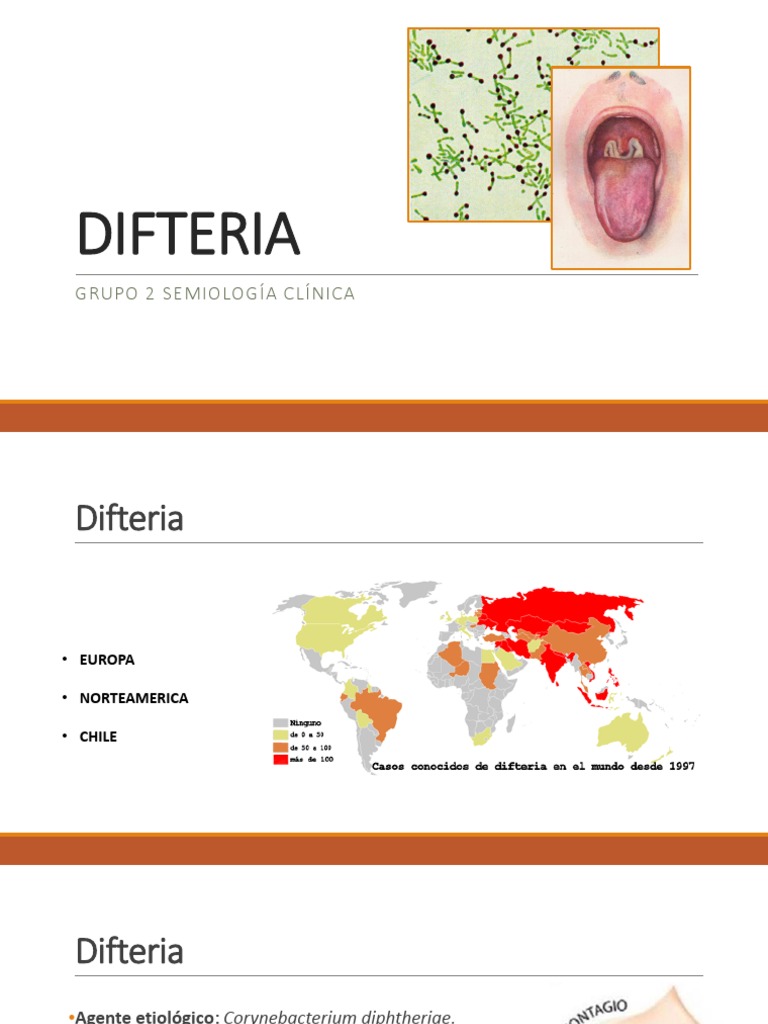 DIFTERIA | PDF | Enfermedades y trastornos | Especialidades Medicas