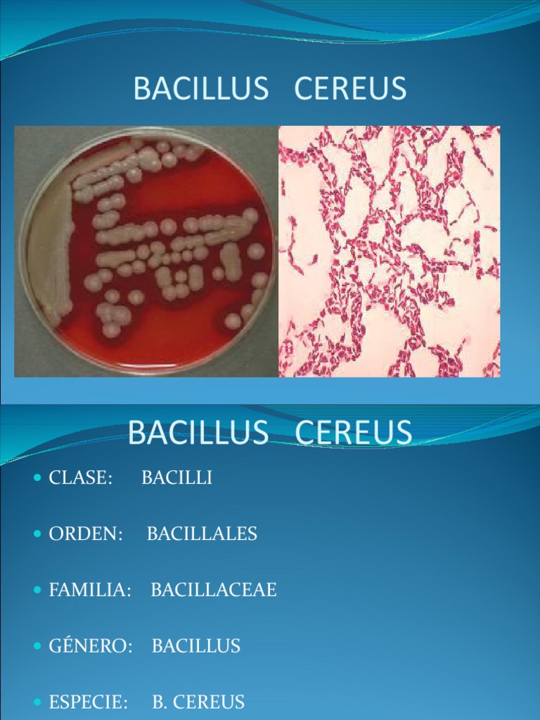 8 Bacillus Cereus | PDF | Enfermedades transmitidas por alimentos | Alimentos