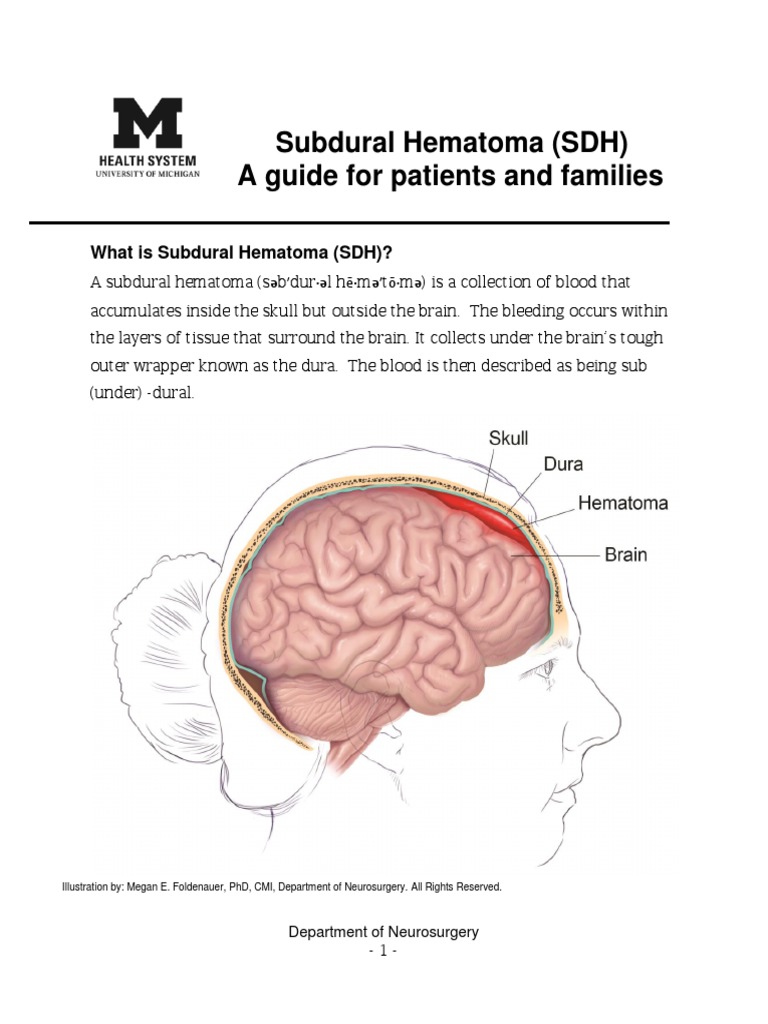 SDH | PDF | Traumatic Brain Injury | Medical Specialties