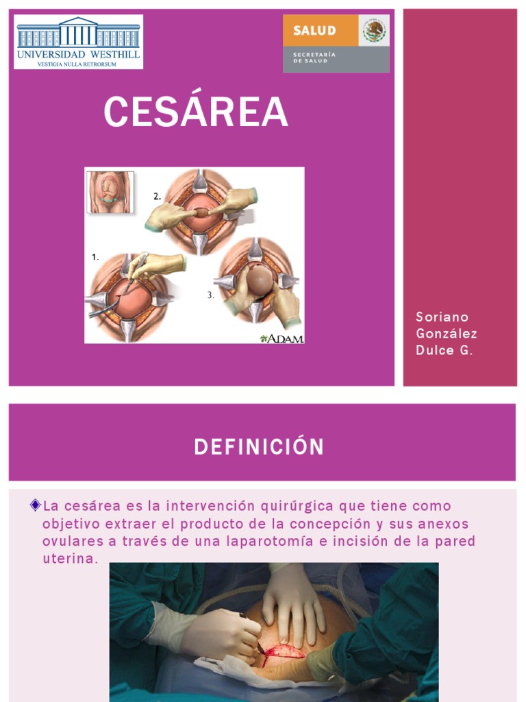Tipos de cesárea y histerorrafia | PDF | Seccion de cesárea | El embarazo