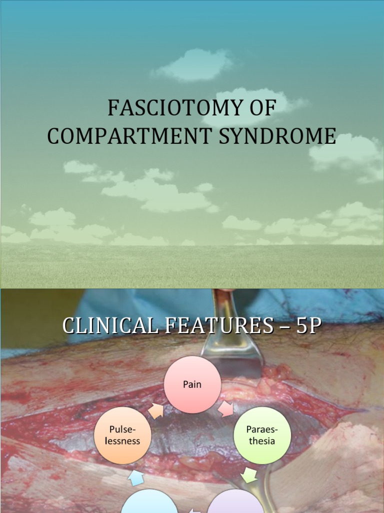 fasciotomy | Musculoskeletal System | Limbs (Anatomy)