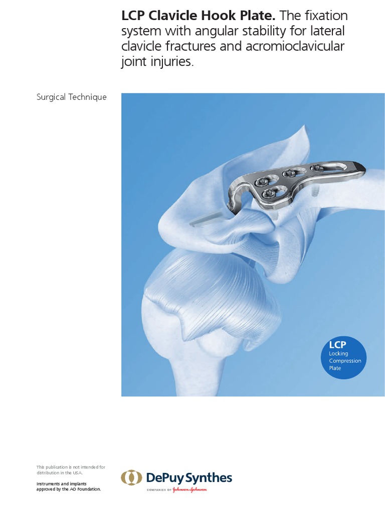 LCP Clavicular Hook Plate - SGT | PDF | Magnetic Resonance Imaging | Screw