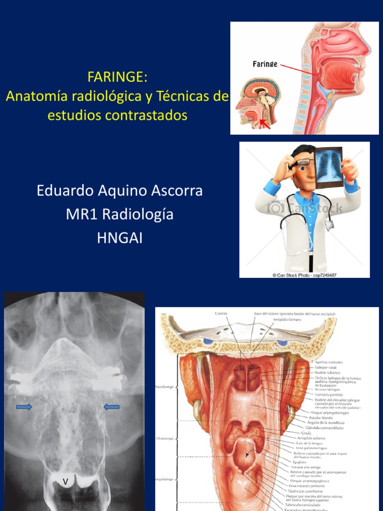 FARINGE. Anatomía y Estudios Contrastados | PDF