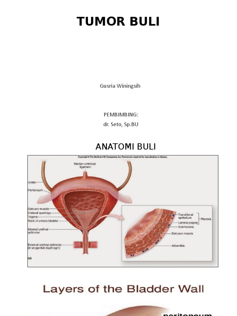 Tumor Buli