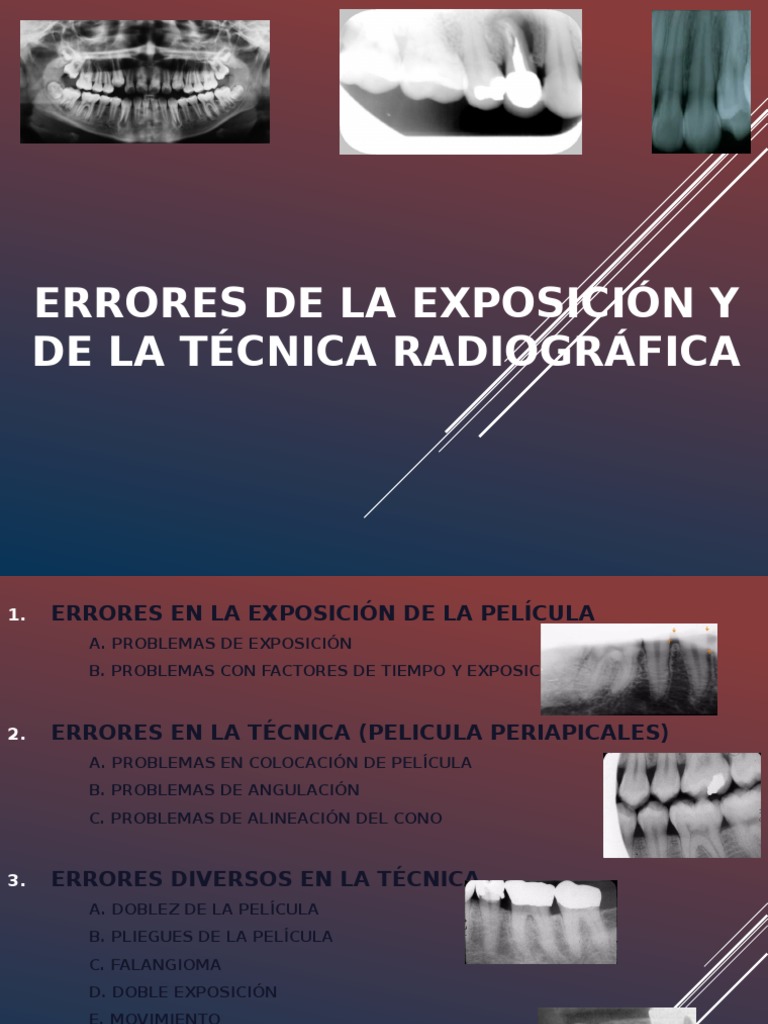 Errores De La Exposición Y De La Técnica Radiográfica Ppt Odontología