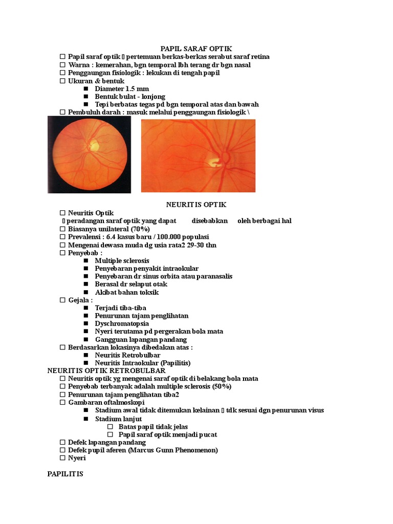Papil Saraf Optik | PDF