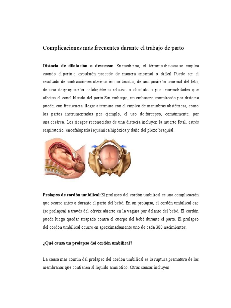 Complicaciones frecuentes en el parto | PDF | Parto | La salud de la mujer
