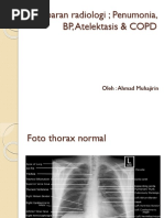 Code Stroke Algorithm | PDF | Stroke | Epidemiology