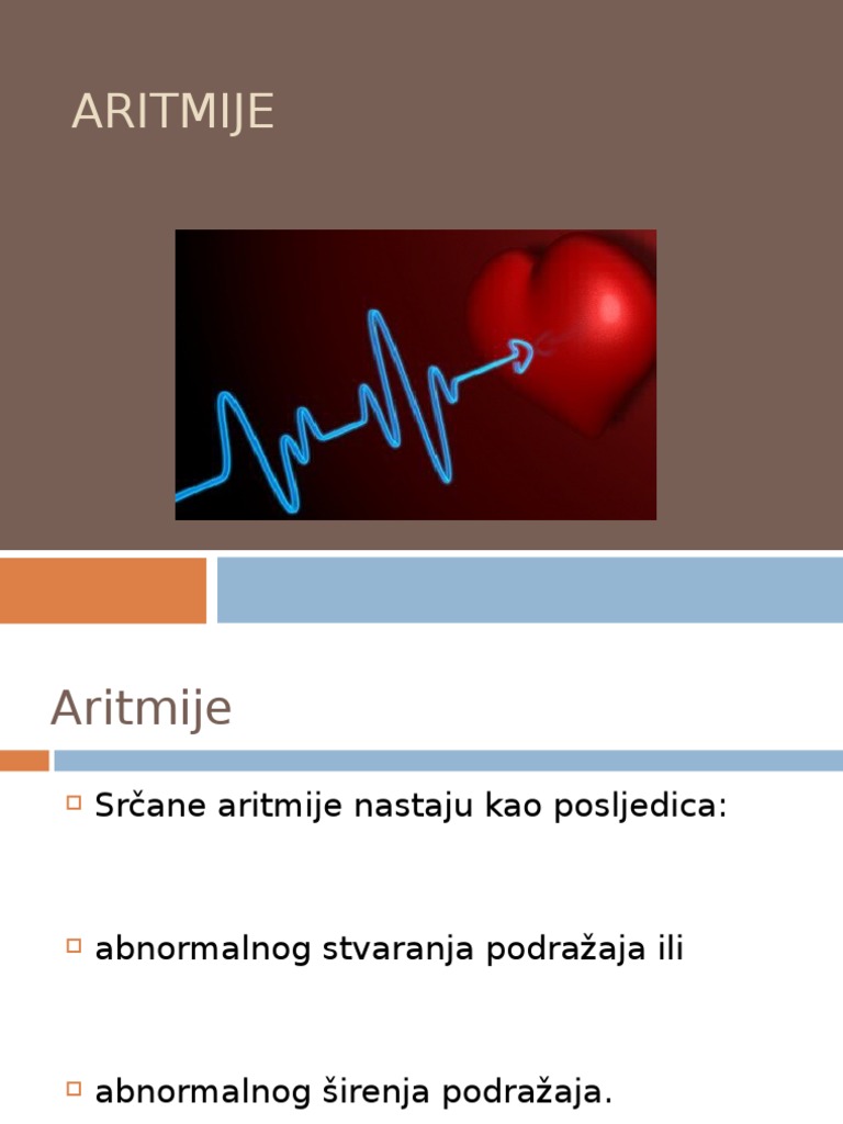 Aritmije | PDF