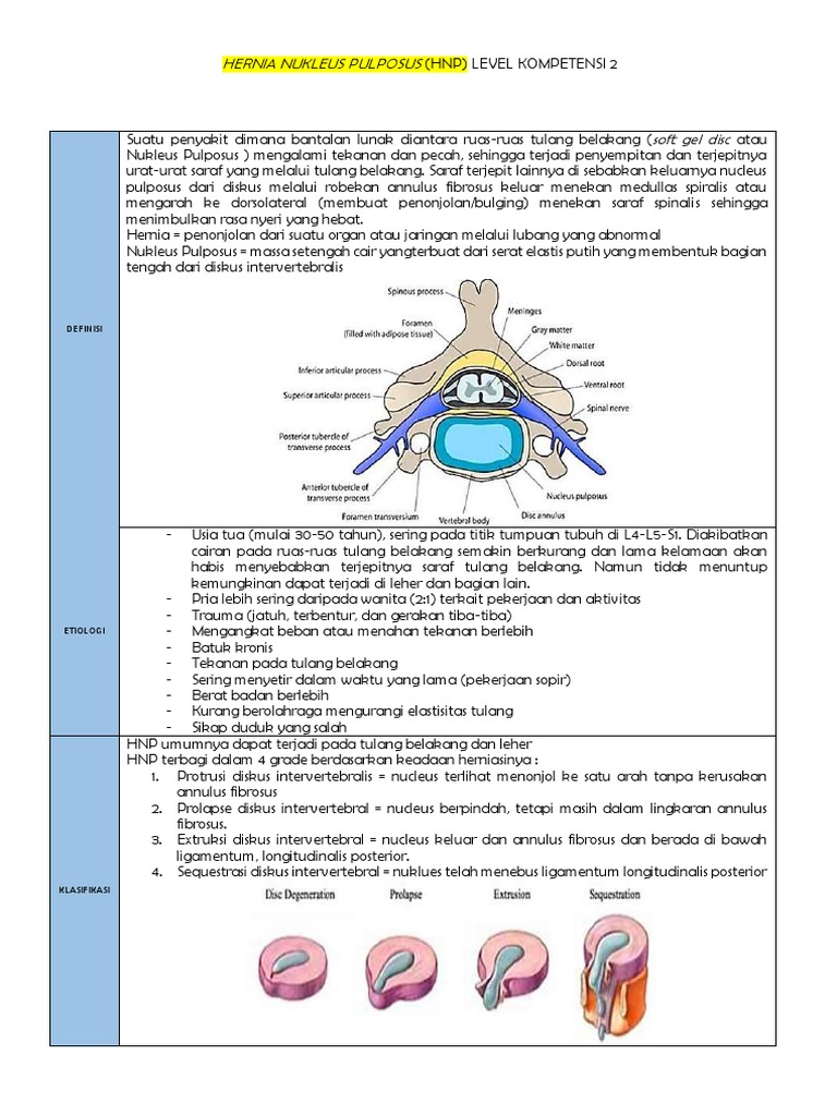 Hernia Nukleus Pulposus (HNP) | PDF