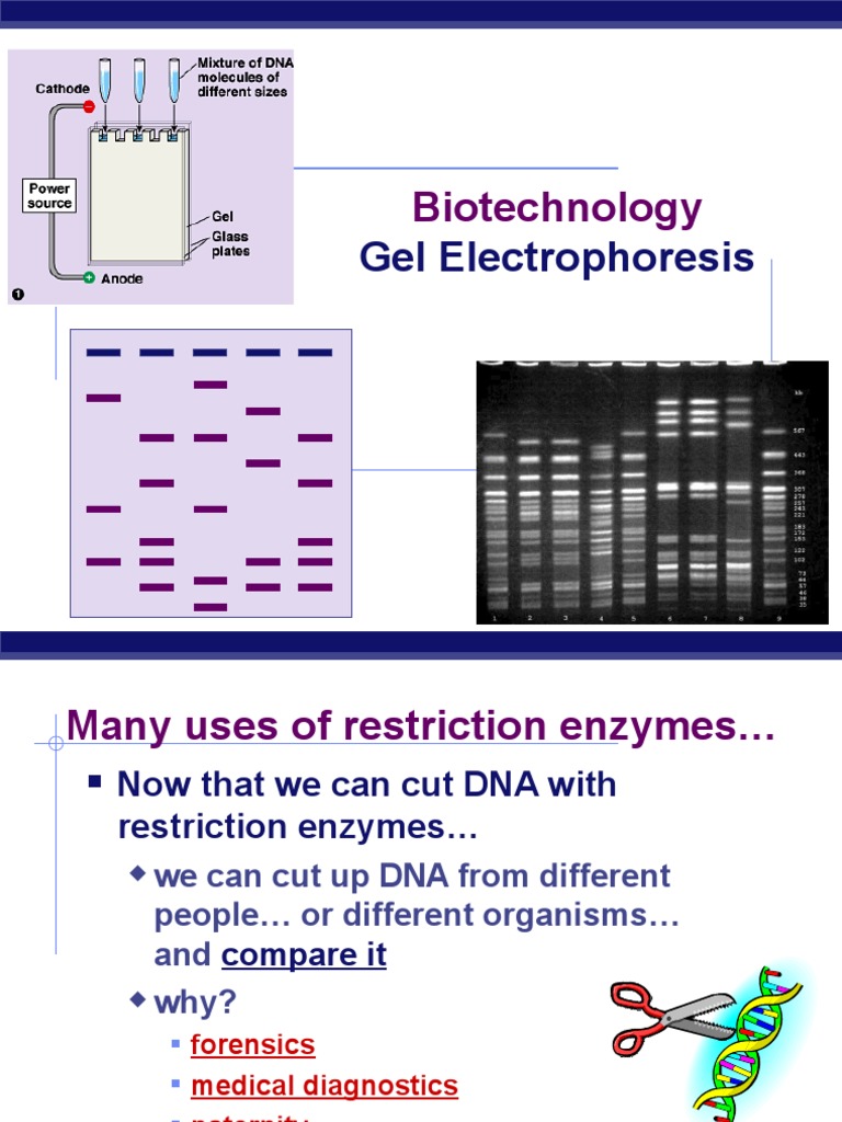 Gel Electrophoresis | Gel Electrophoresis | Dna Profiling