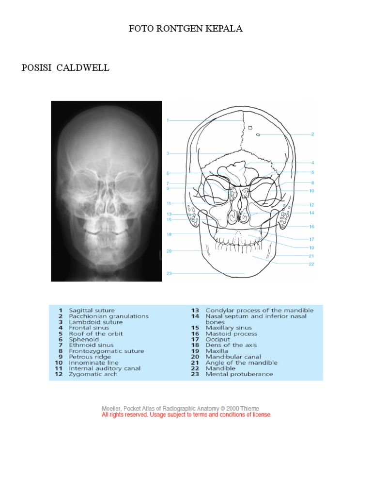 Posisi Rontgen Kepala Lengkap | PDF