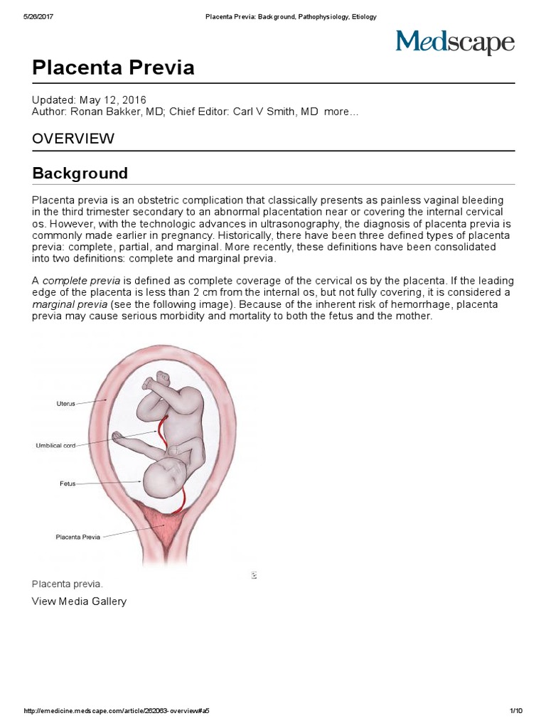 Placenta Previa - Medscape | PDF | Childbirth | Placenta