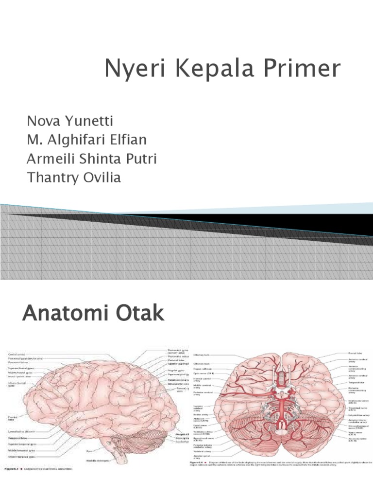 Presentation1 Case Cephalgia Edited | PDF