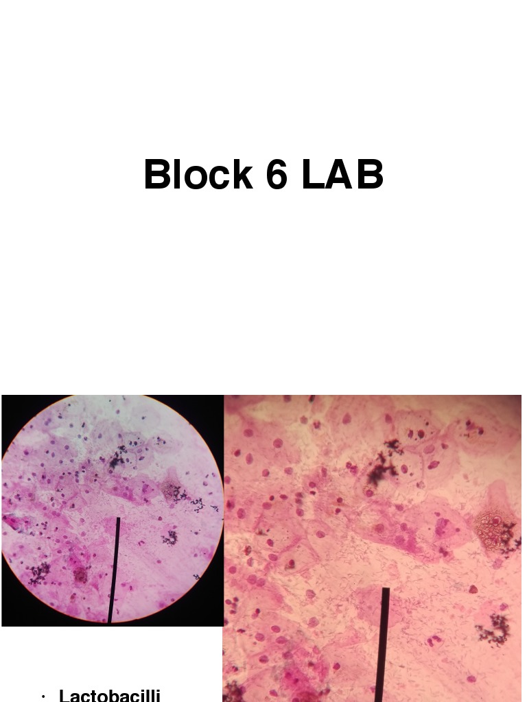 Histopathology Findings of Various Female Reproductive System Specimens ...